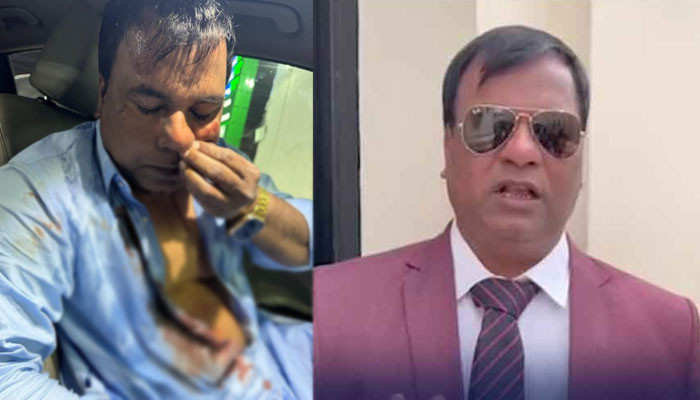 پاکستانی اسٹیج آرٹسٹ طاہر انجم قاتلانہ حملے میں بال بال بچ گئے